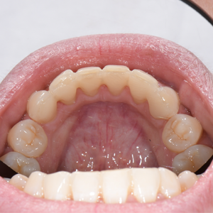 Les soins - Dr Clément Robert - Dr Anthony Duhin - Cabinet Vauban